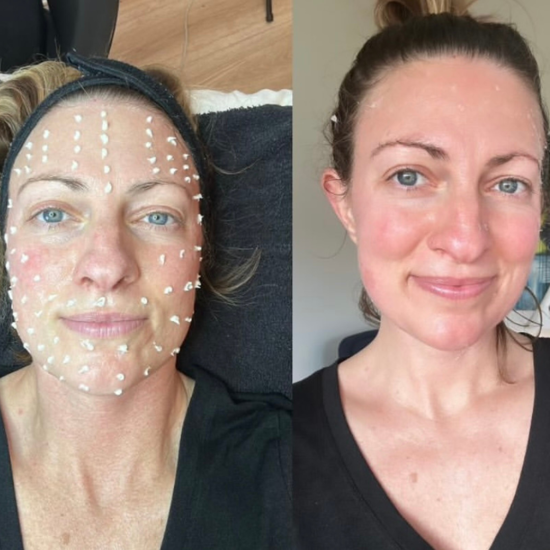 Virtue Holistic Facials – Virtue Skin Studio